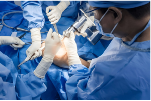 Understanding Polytrauma Surgeries: Treating Multiple Fractures and ...